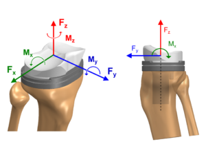 Knee joint « OrthoLoad
